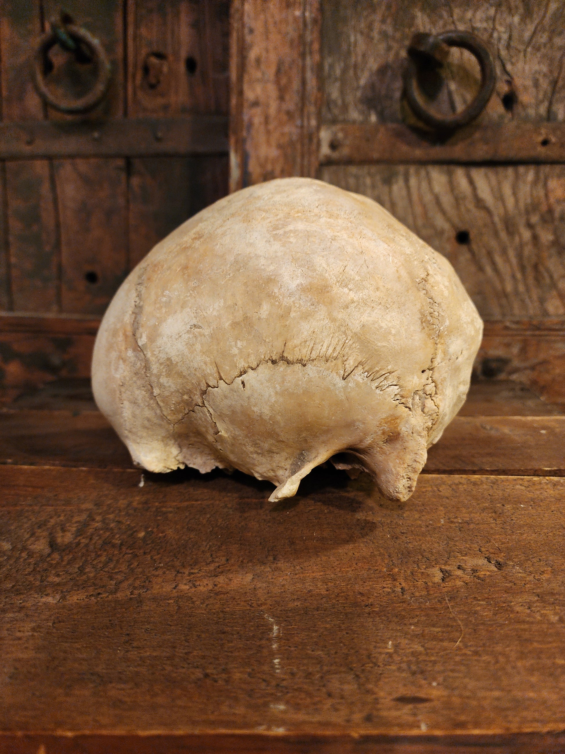 Medical Human Crown/Corona Capitis. – Blackhollow Fever